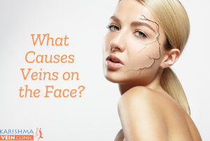 Veins On Face - Understanding The Underlying Factors